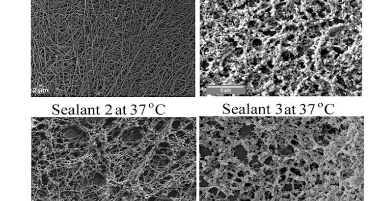 Nature-inspired artificial peptides for faster blood clotting ...
