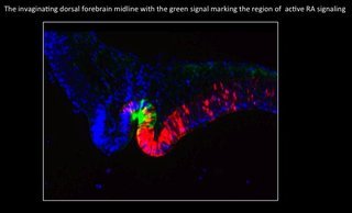 New role for retinoic acid in chick forebrain development discovered ...