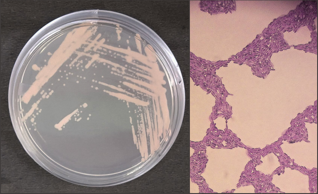 The Pink Solution: "N-riching" rice plants - IndiaBioscience