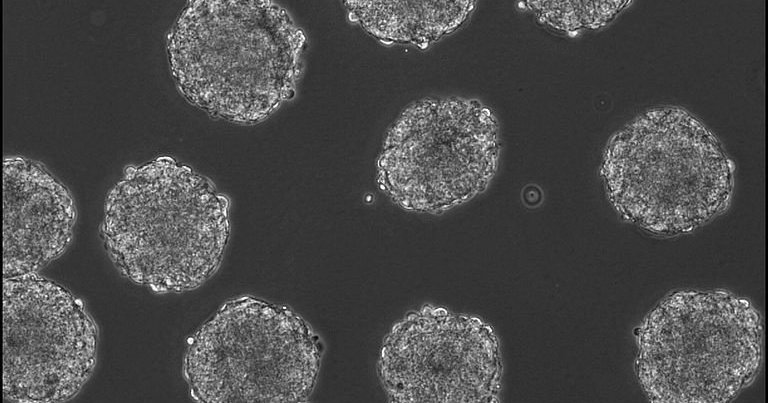 How stem cells retain their “stem” ness: The science of staying ...