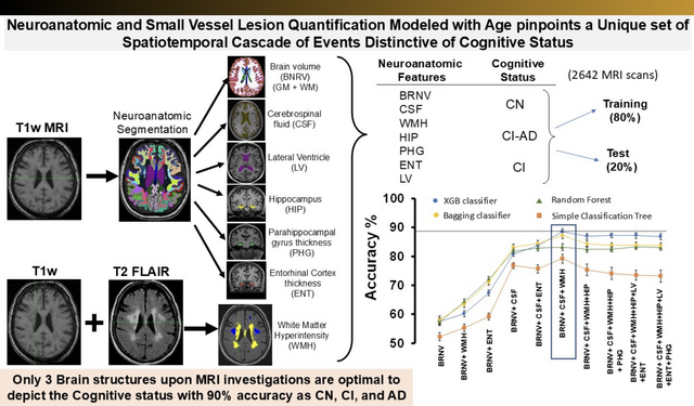 Can our brains age before us? Decoding brain ageing with neuroimaging ...