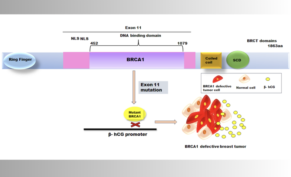 Understanding BRCA1 mutations in breast cancer - IndiaBioscience