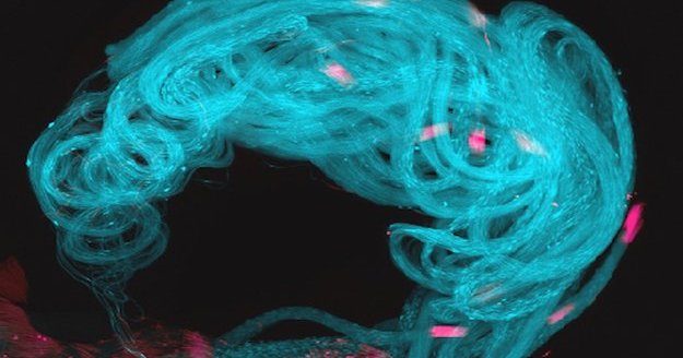 The ‘tail’ of two cells: sperms wiggle out while avoiding head-on ...